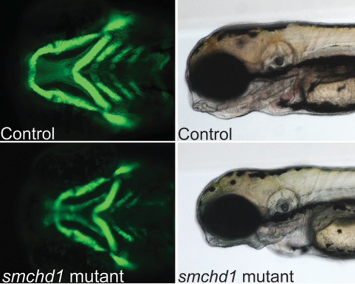 Duke Researchers Help Identify Genetic Basis for Lack of a Nose | Duke ...